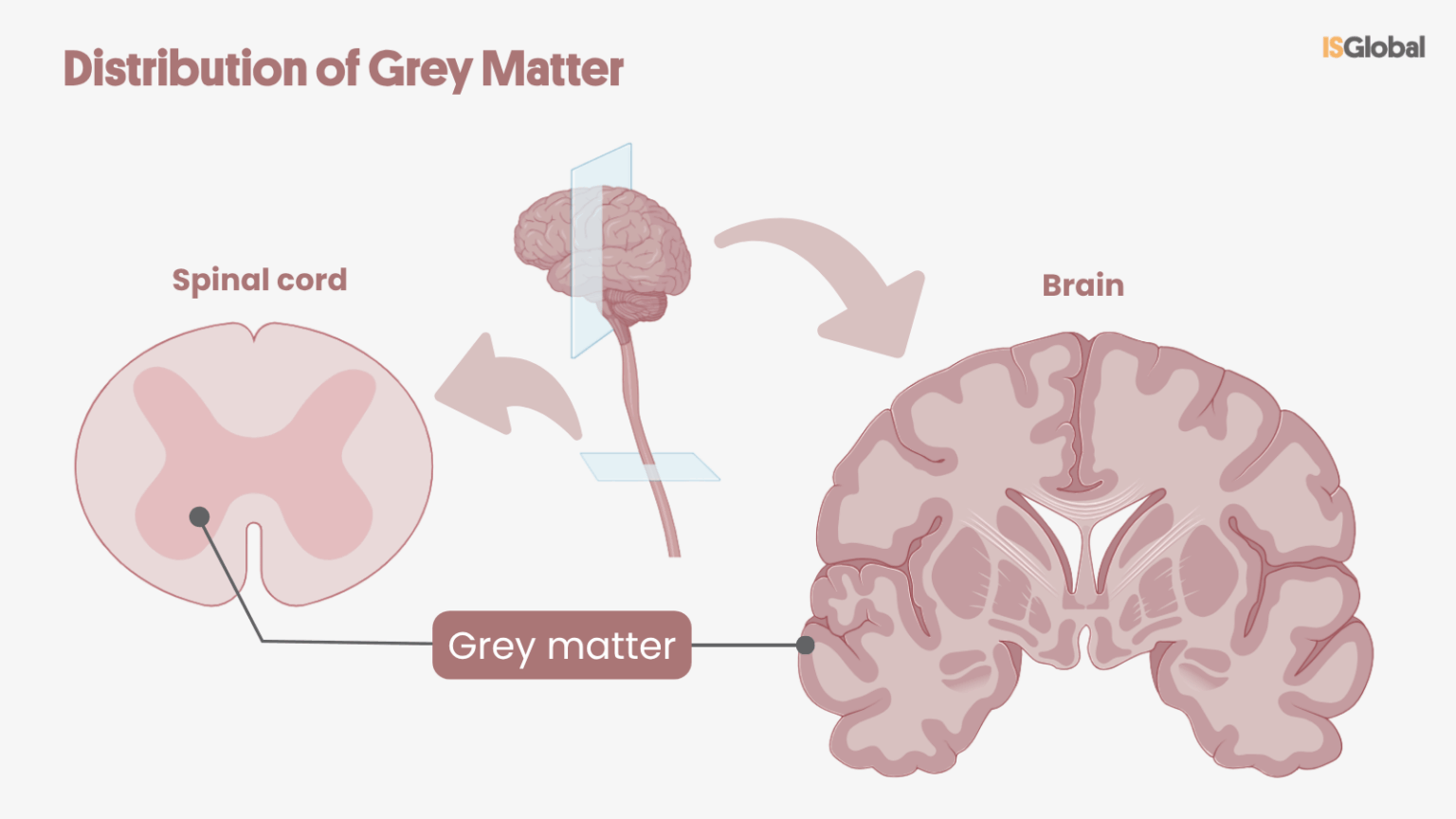 Grey matter - Diccionario de Salud Global